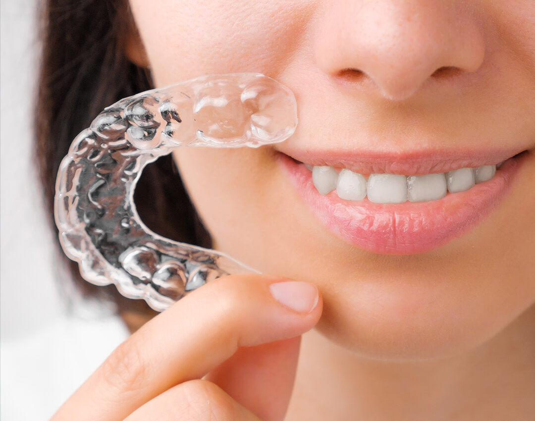 Clear-Lock Retainers in Forest Hills | Madison Dental