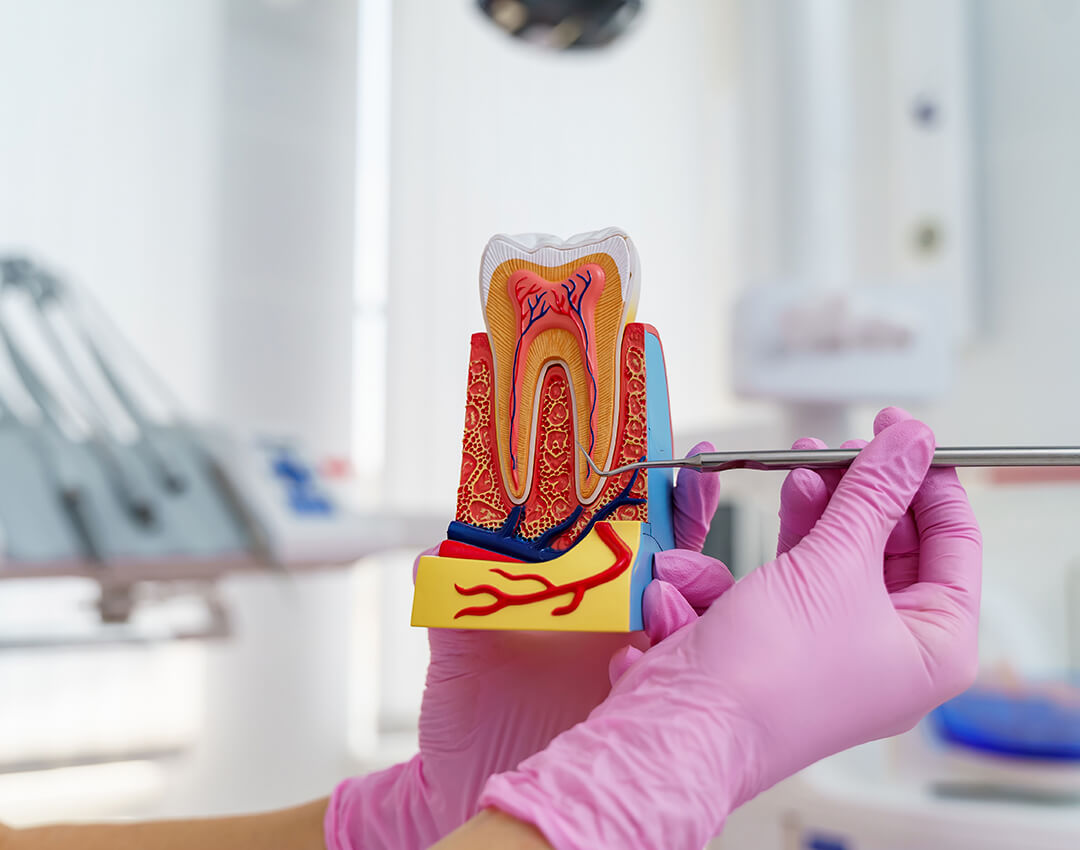 Root Canal Endodontist in Forest Hills | Madison Dental