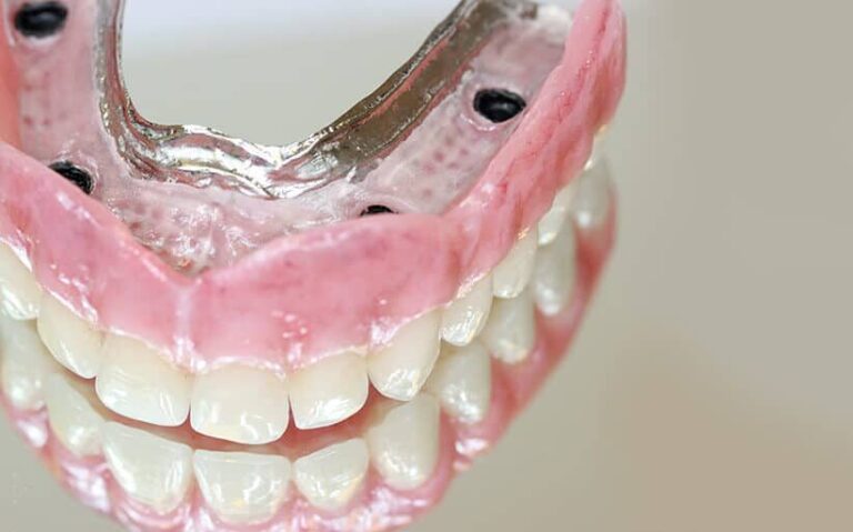 How Much Does a Set of Dentures Cost? Find Out Now | Madison Dental Art