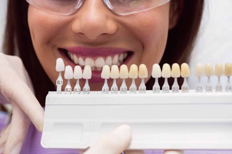 Composite vs Porcelain Veneers: Key Differences, Pros & Cons | Madison Dental Art