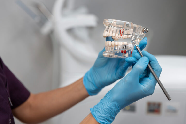 What Affects the Cost of a Dental Crown Most?