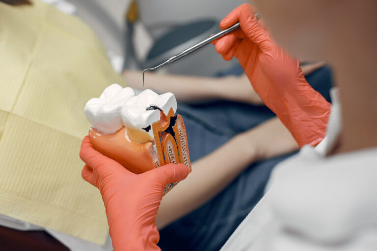 Can a Root Canal Get Reinfected? Here’s What You Need to Know | Madison ...